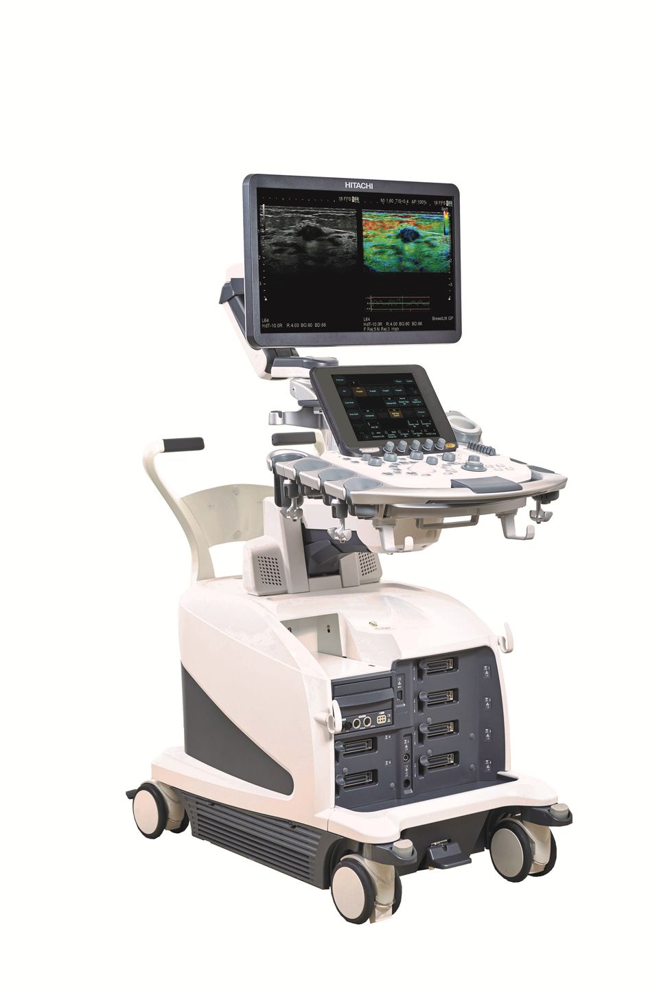 Hitachi Medical Systems Europe launches “ARIETTA 750”, the new model ...