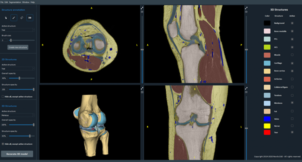 Norsk AI-startup nominert til prestisjetung pris | NordicCAD